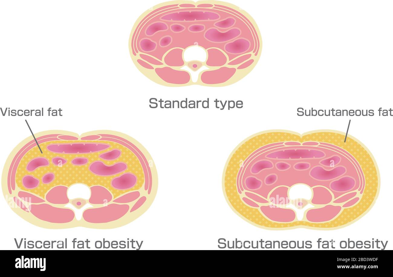 Subcutaneous fat hi-res stock photography and images - Alamy