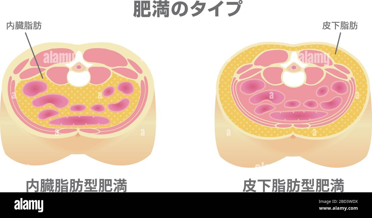 Subcutaneous Fat High Resolution Stock Photography and Images - Alamy