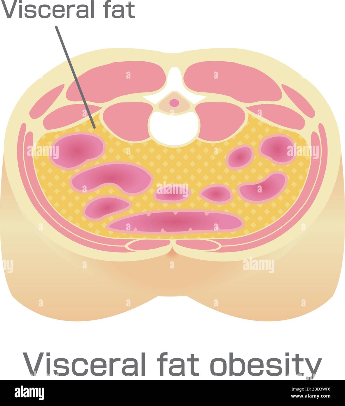 Abdominal obesity hi-res stock photography and images - Alamy