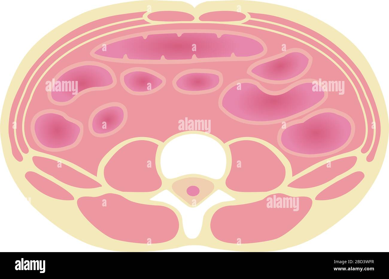 Type of obesity illustration . Abdominal sectional View . Healthy body ...