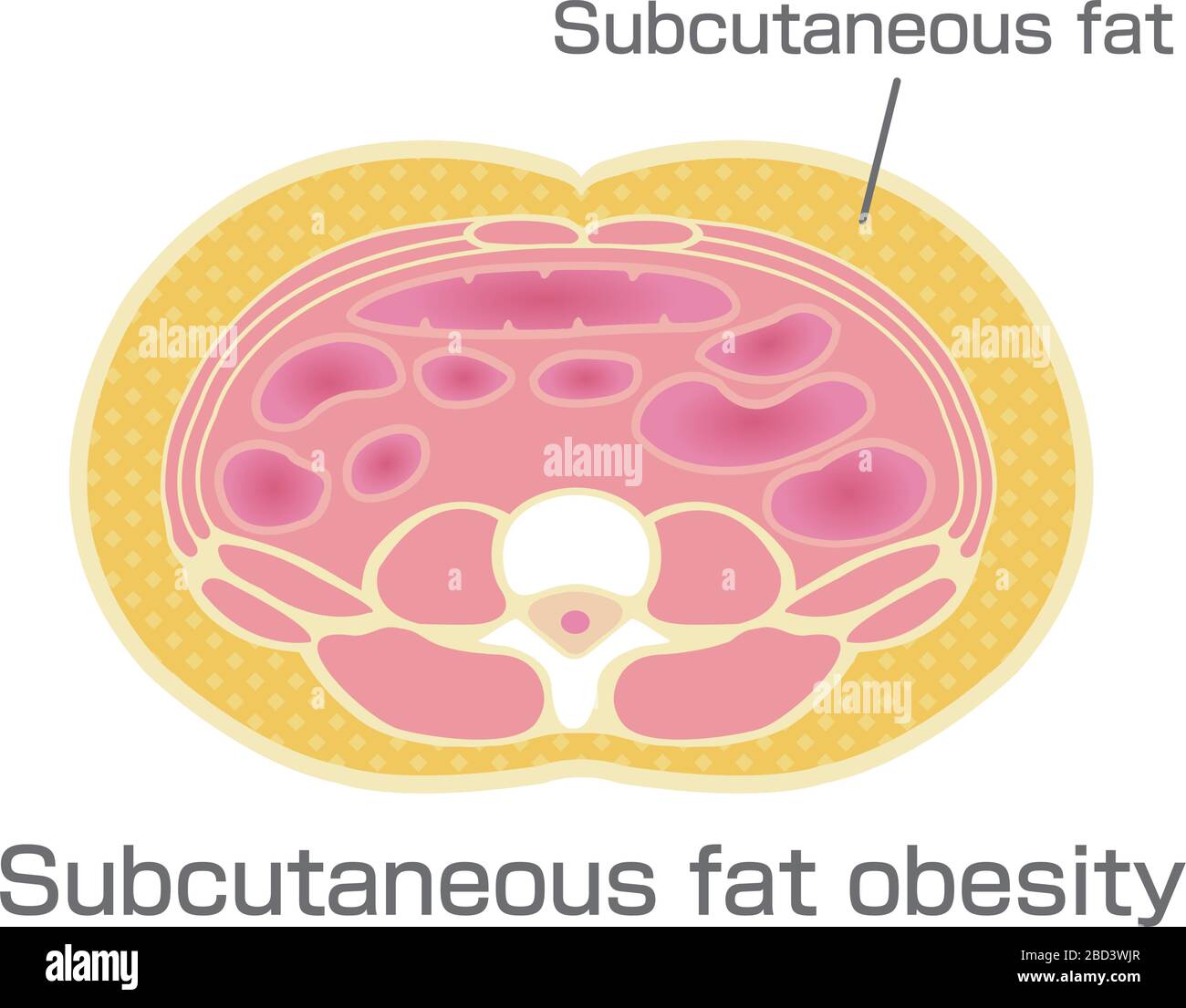 Subcutaneous fat hi-res stock photography and images - Alamy