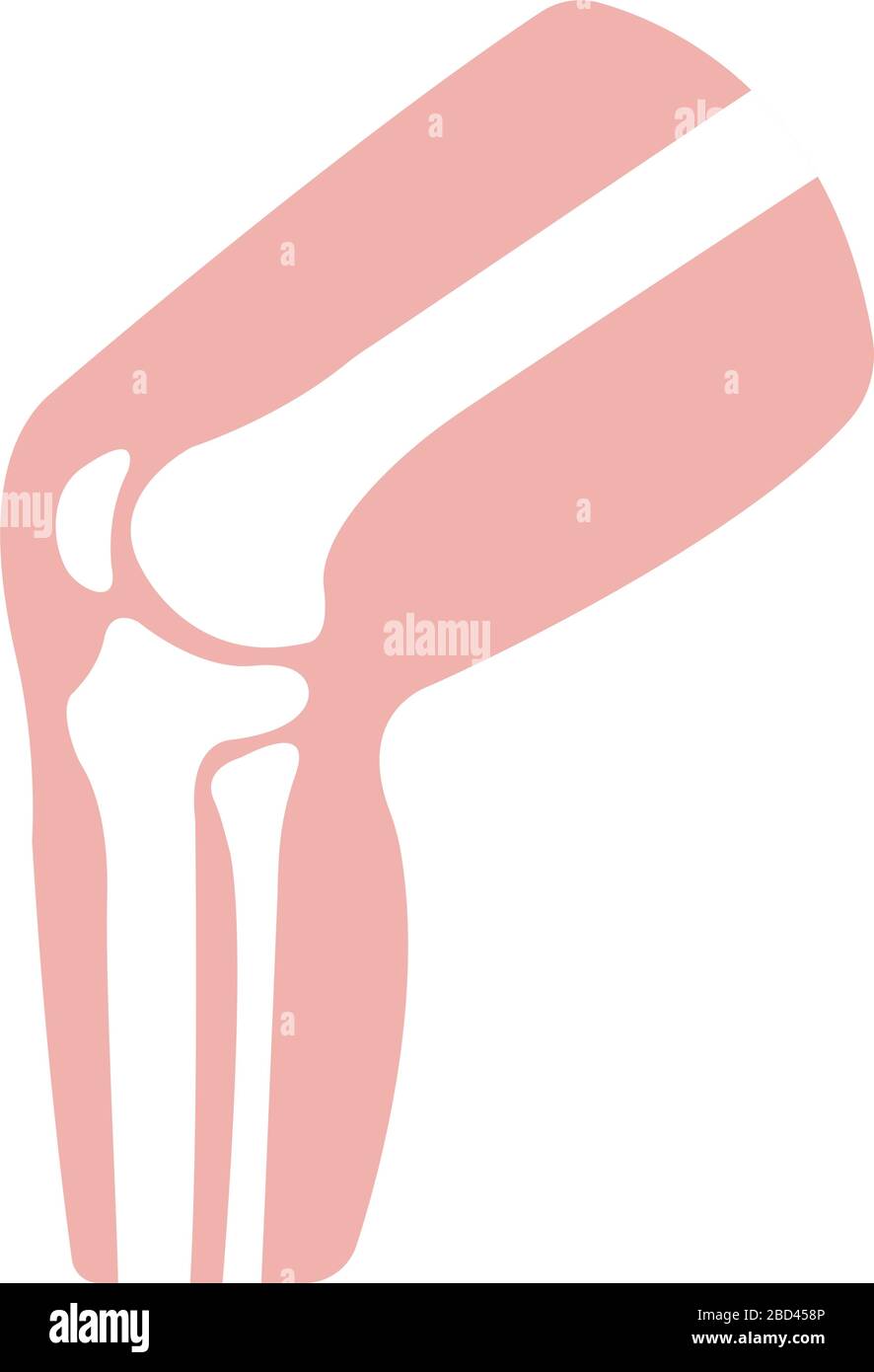 Joint inflammation illustration Stock Vector Images - Alamy