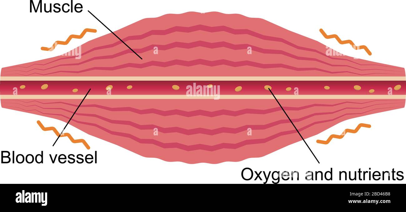 Muscle becomes tense . Flat illustration of muscle and vessel Stock ...