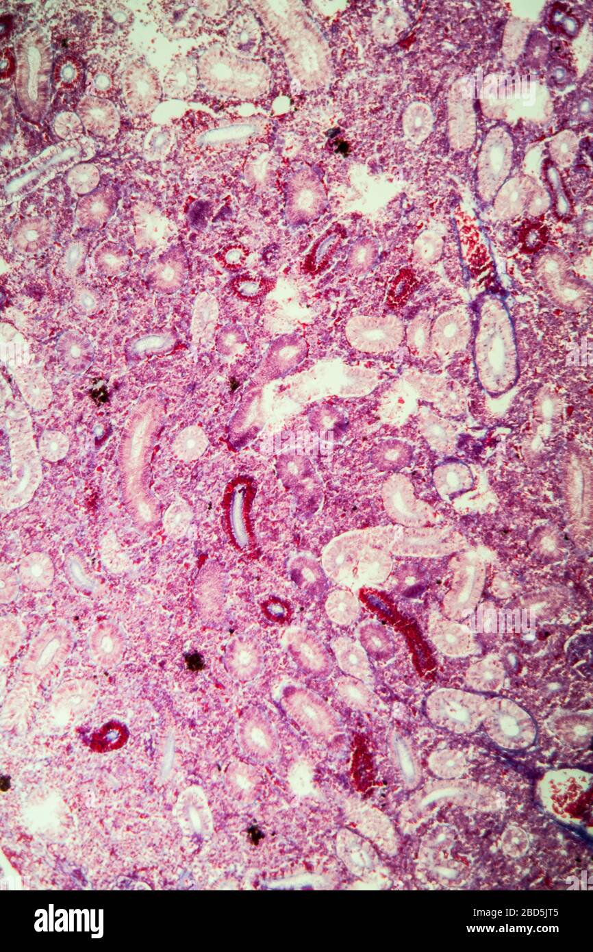Cross section of the kidney 100x hi-res stock photography and images ...