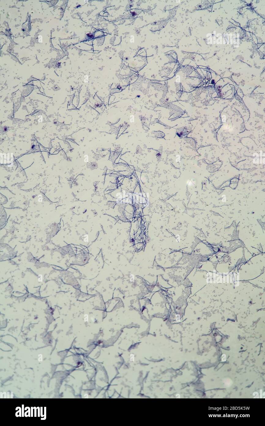 Bacteria from the plaque 200x Stock Photo - Alamy