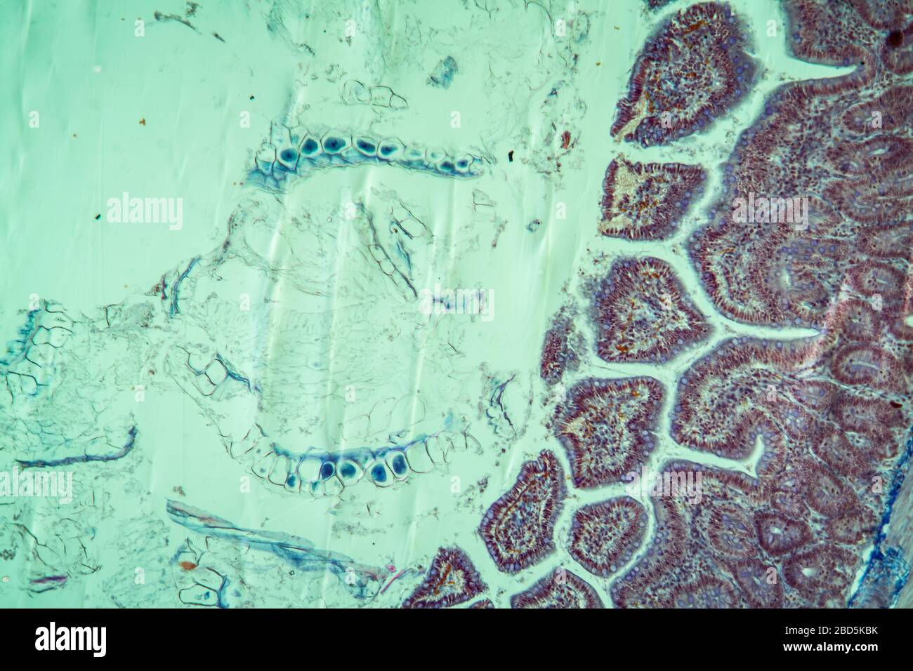 Amoebic dysentery hi-res stock photography and images - Alamy