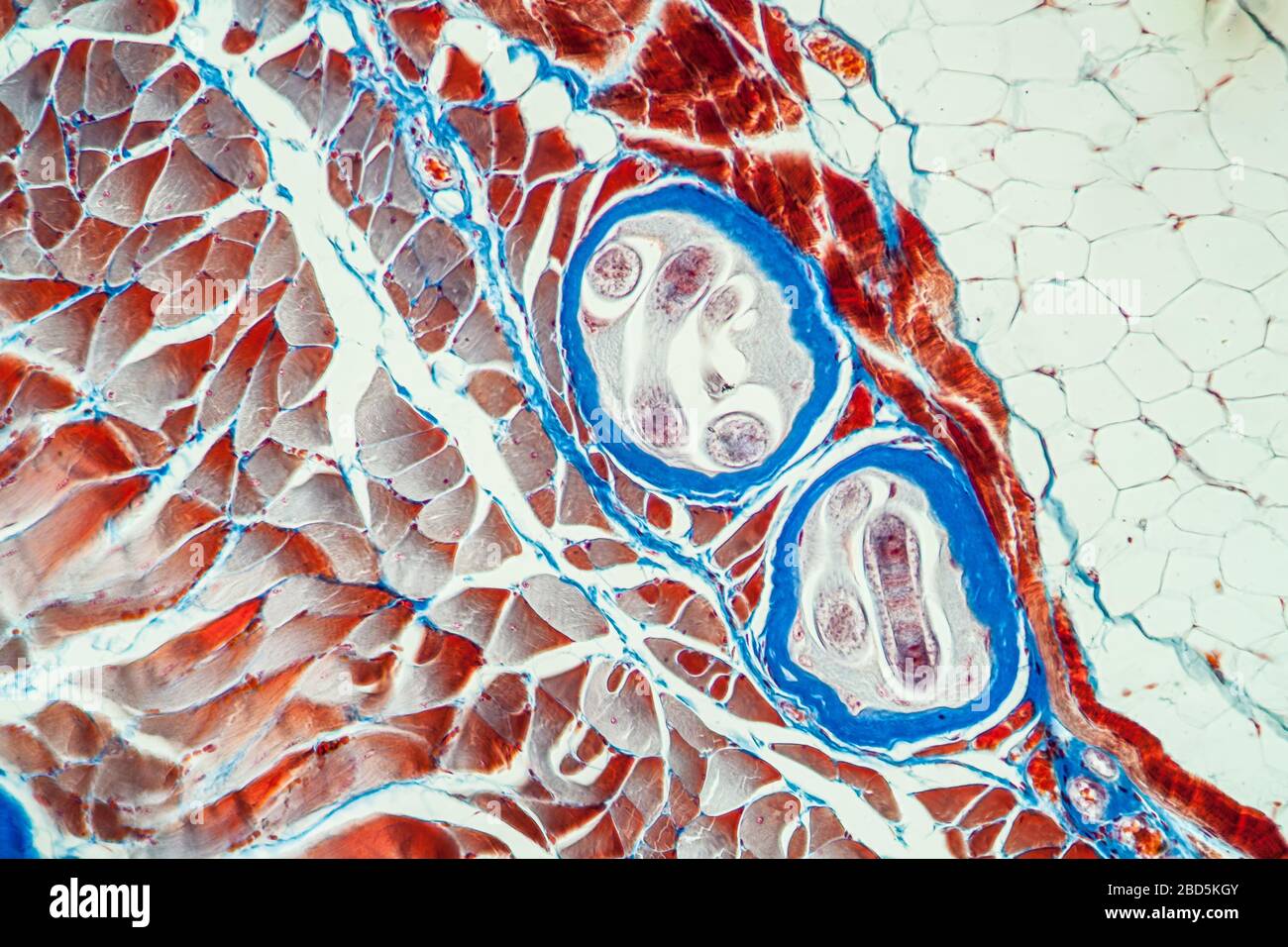 Muscle trichinae hi-res stock photography and images - Alamy