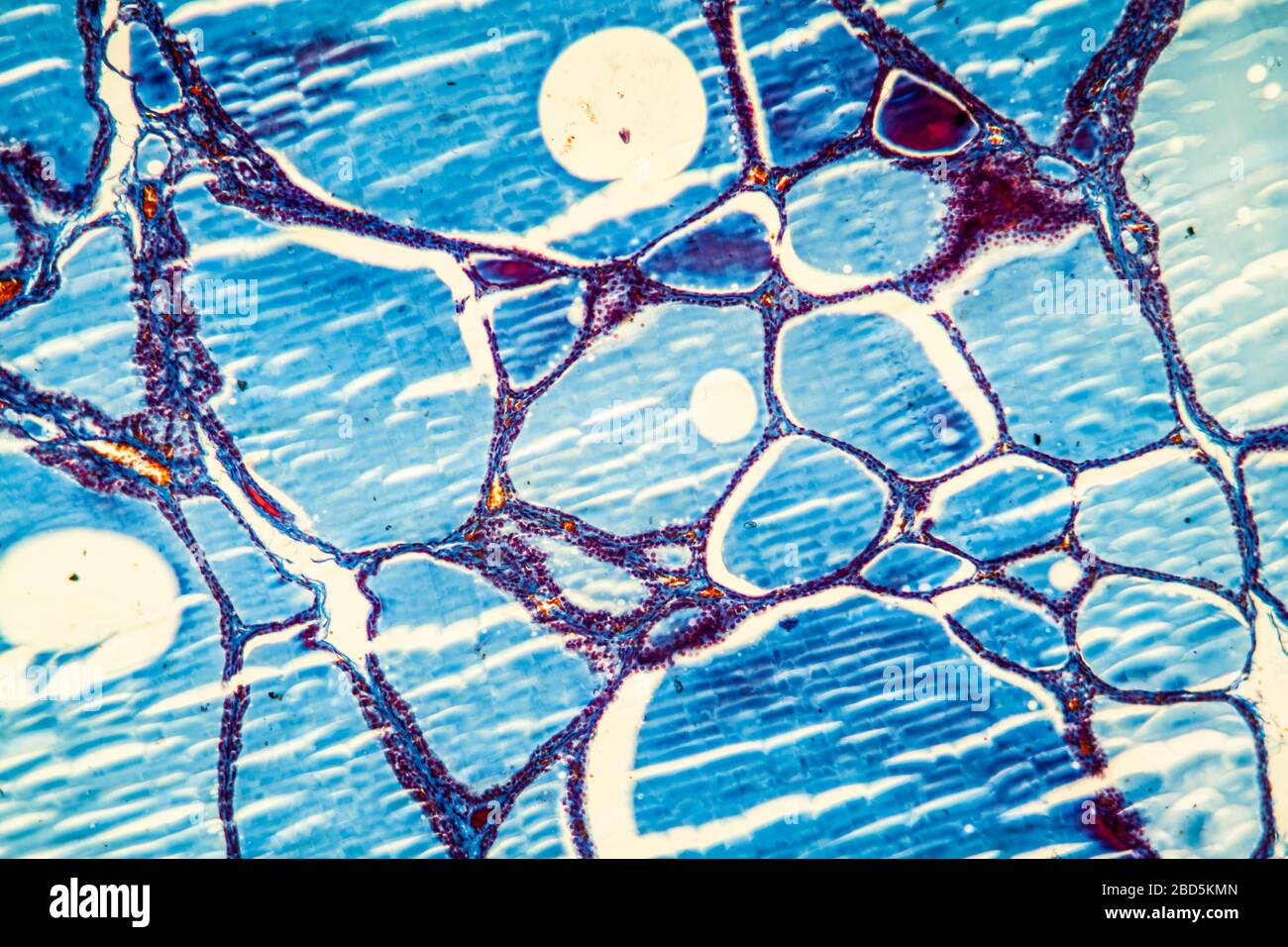 Goiter, neck hi-res stock photography and images - Alamy