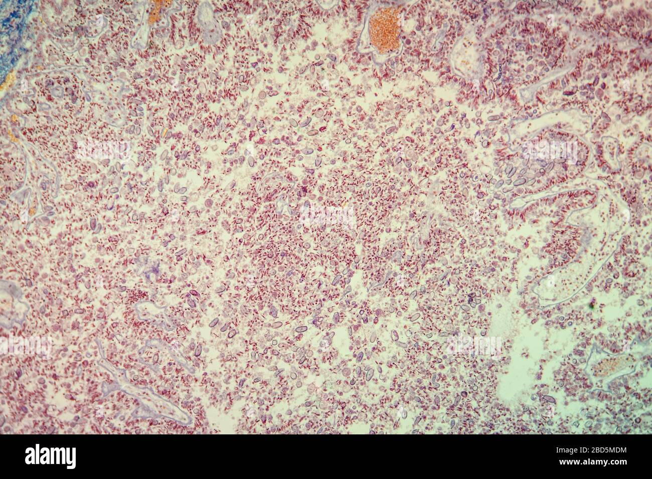 Coccidiosis of liver tissue under the microscope 100x Stock Photo - Alamy