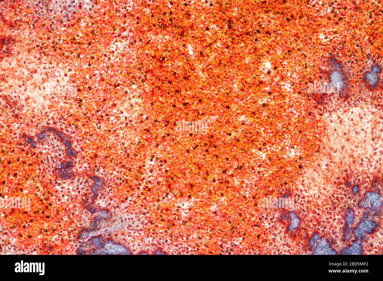 Heart tissue microscope hi-res stock photography and images - Alamy