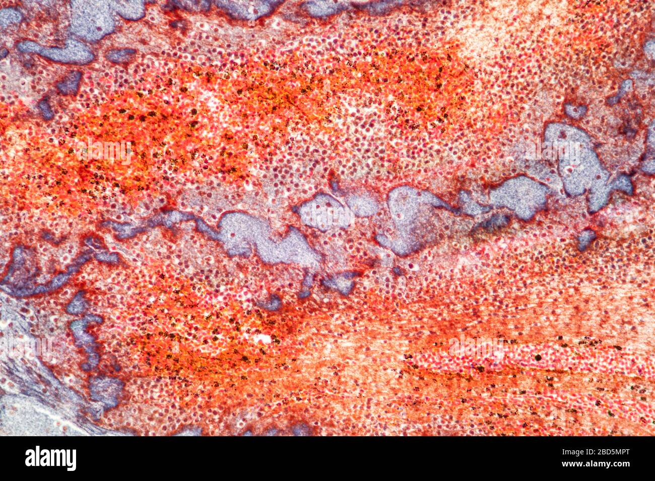 Fat heart tissue under the microscope 100x Stock Photo - Alamy