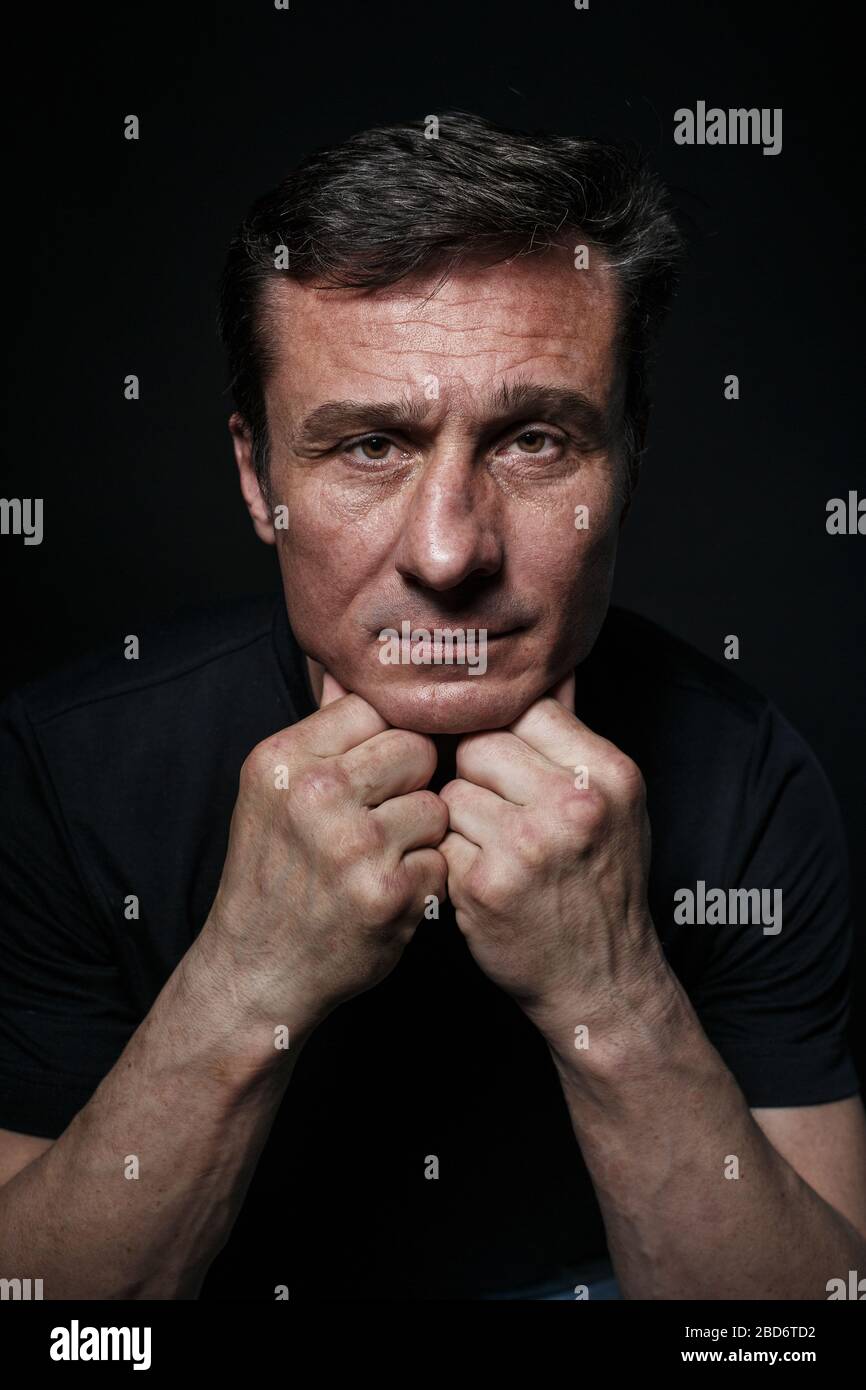 Broken nose hi-res stock photography and images - Alamy