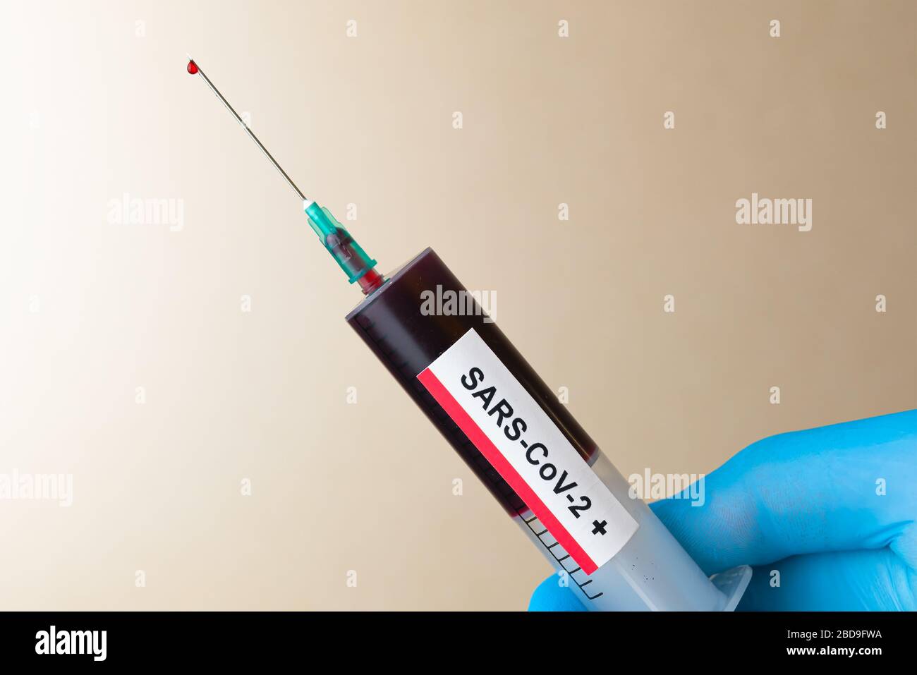 Doctors hand in glove holds syringe with positive Coronavirus blood ...