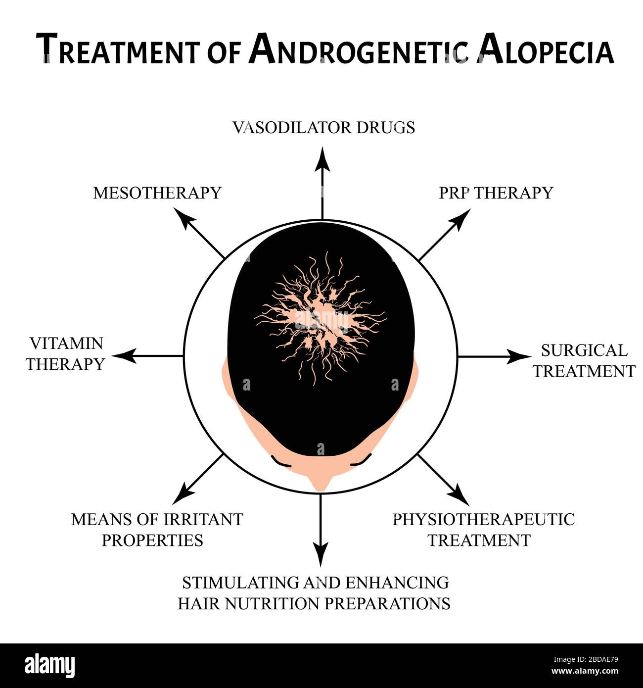 Treatment Of Alopecia Bald Spot Baldness Alopecia Mesotherapy