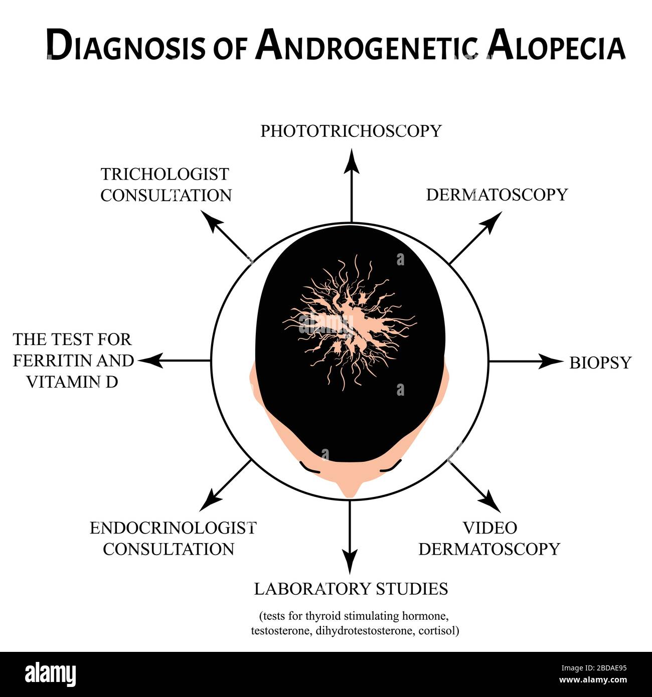 Diagnosis of alopecia. Bald spot, baldness, Alopecia mesotherapy ...