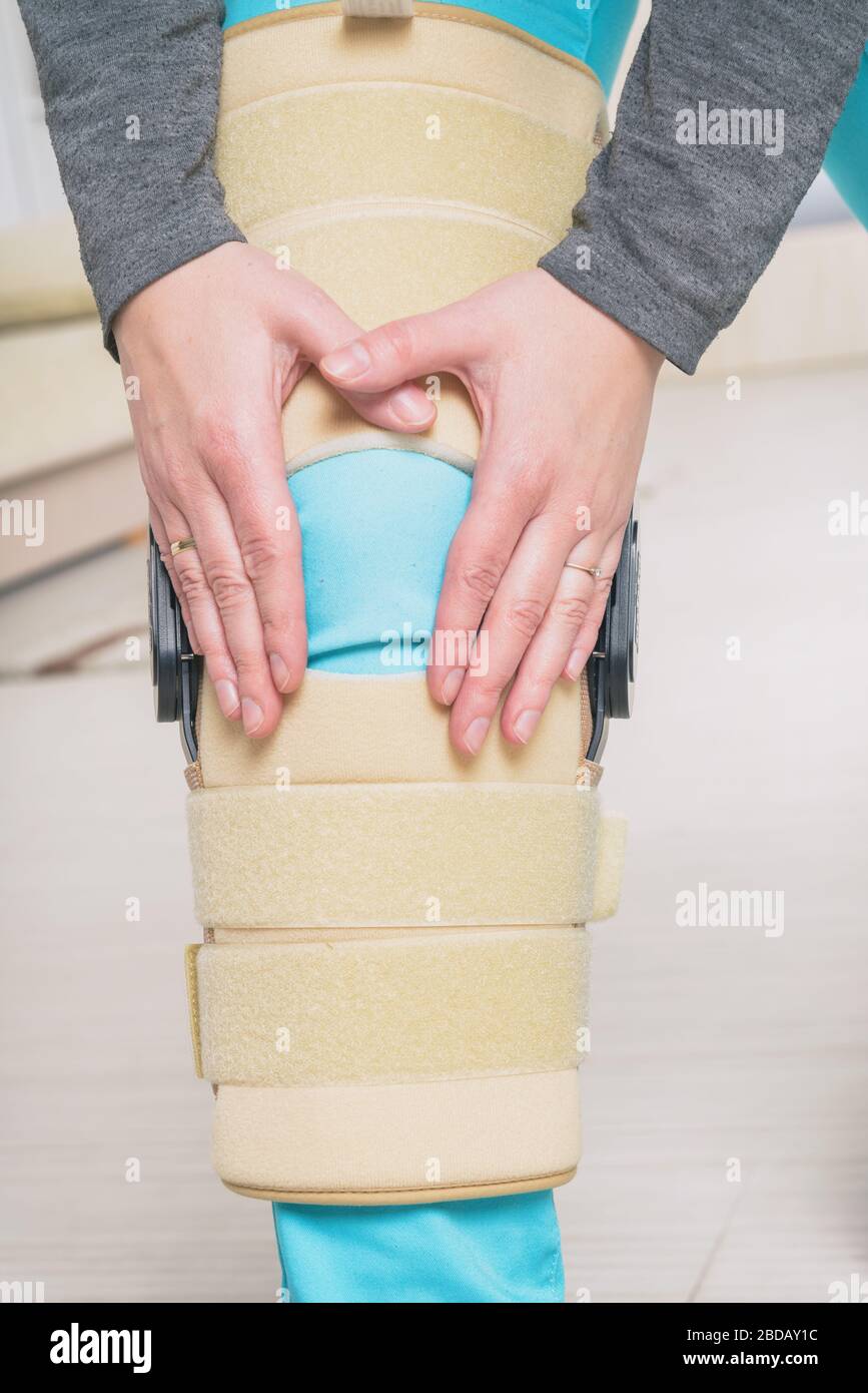 Woman's leg in knee cages for stabilization and support Stock Photo - Alamy