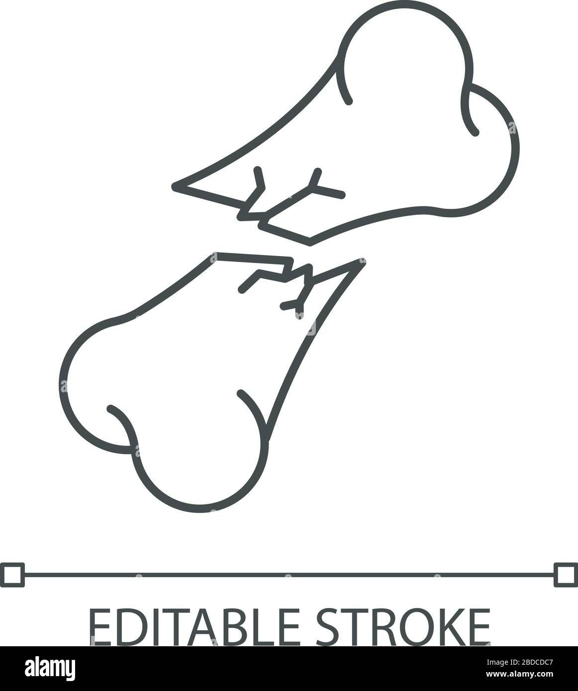 Fracture of the nasal cartilage Black and White Stock Photos & Images ...