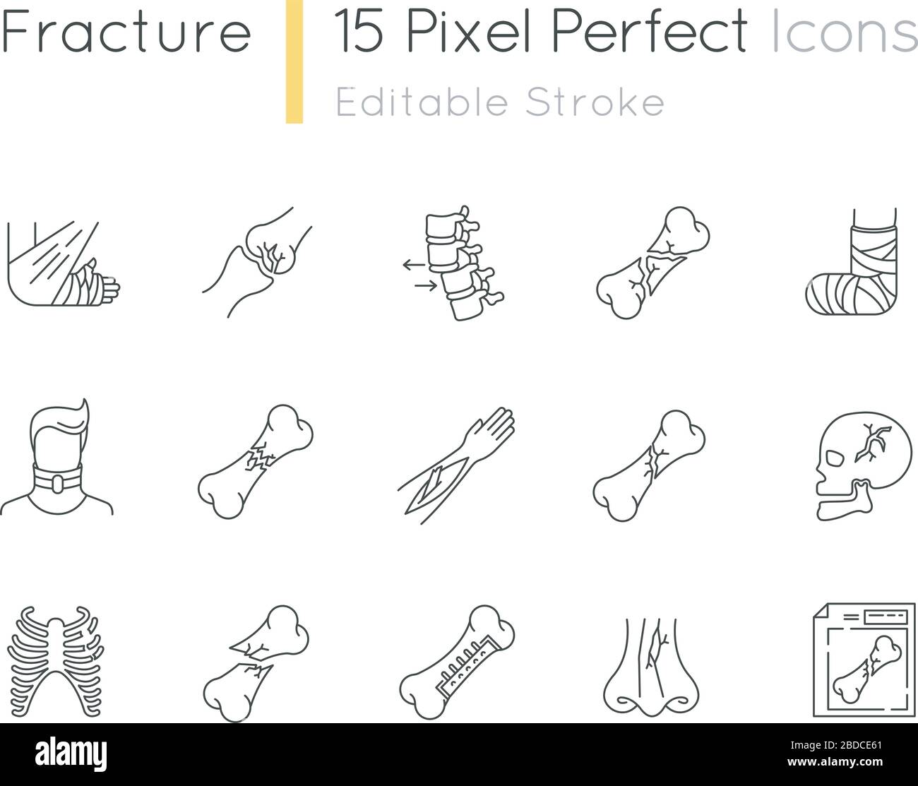 Linear Bone Fracture