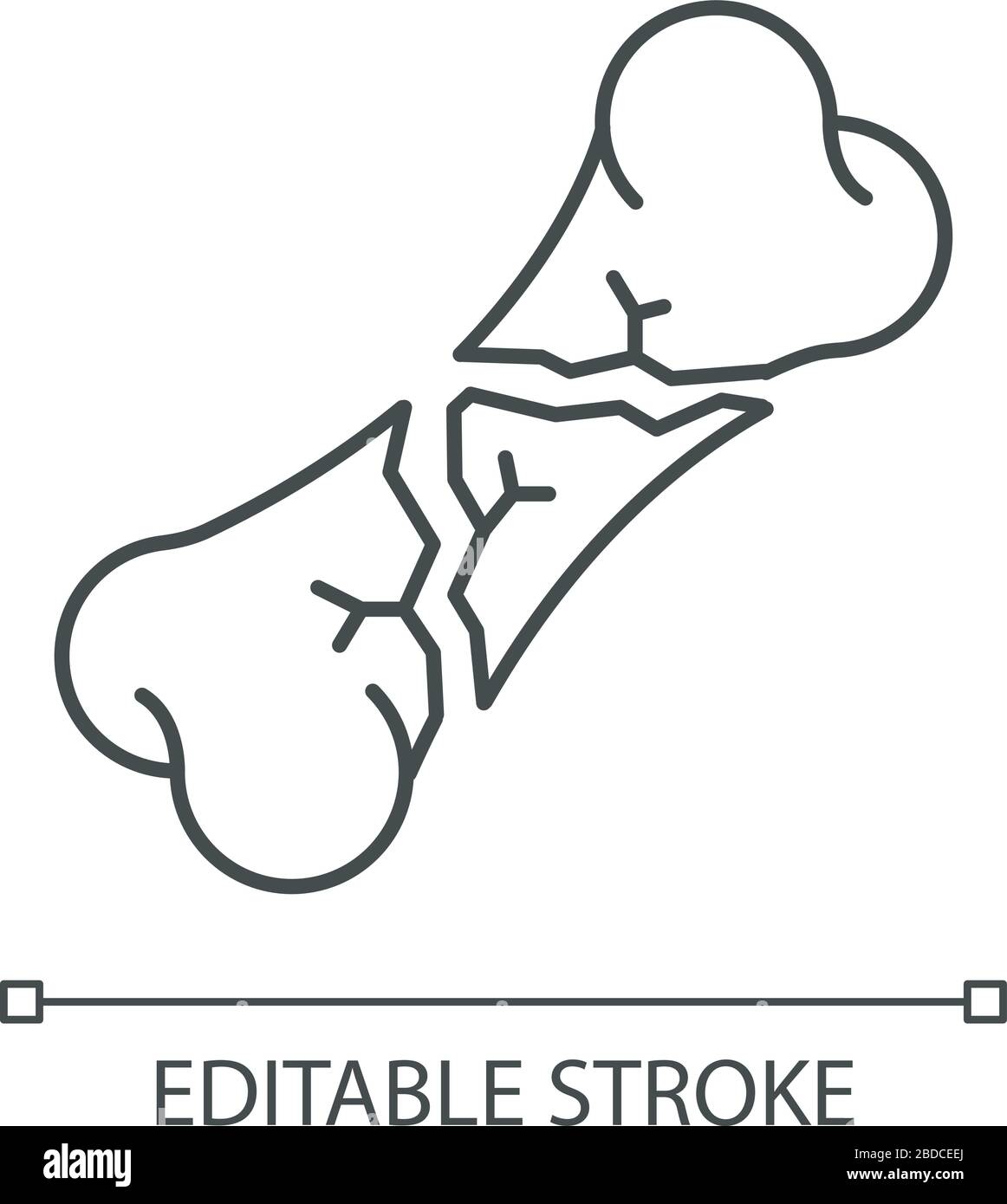 Comminuted fracture hi-res stock photography and images - Alamy