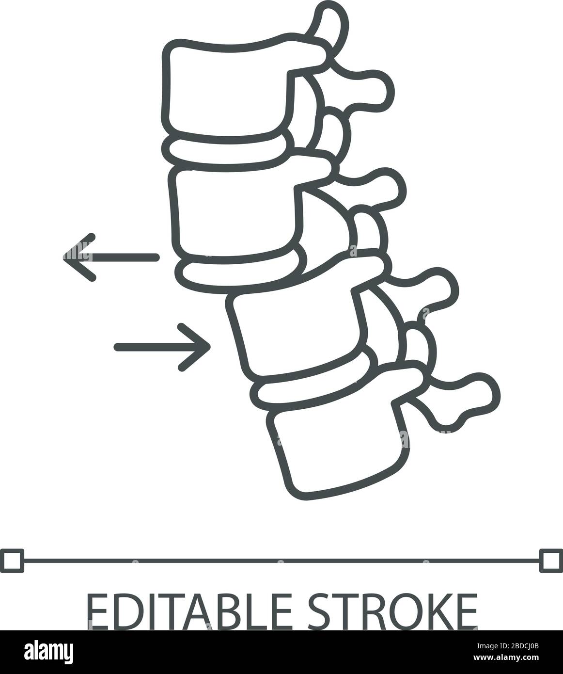 Vertebral displacement Stock Vector Images - Alamy