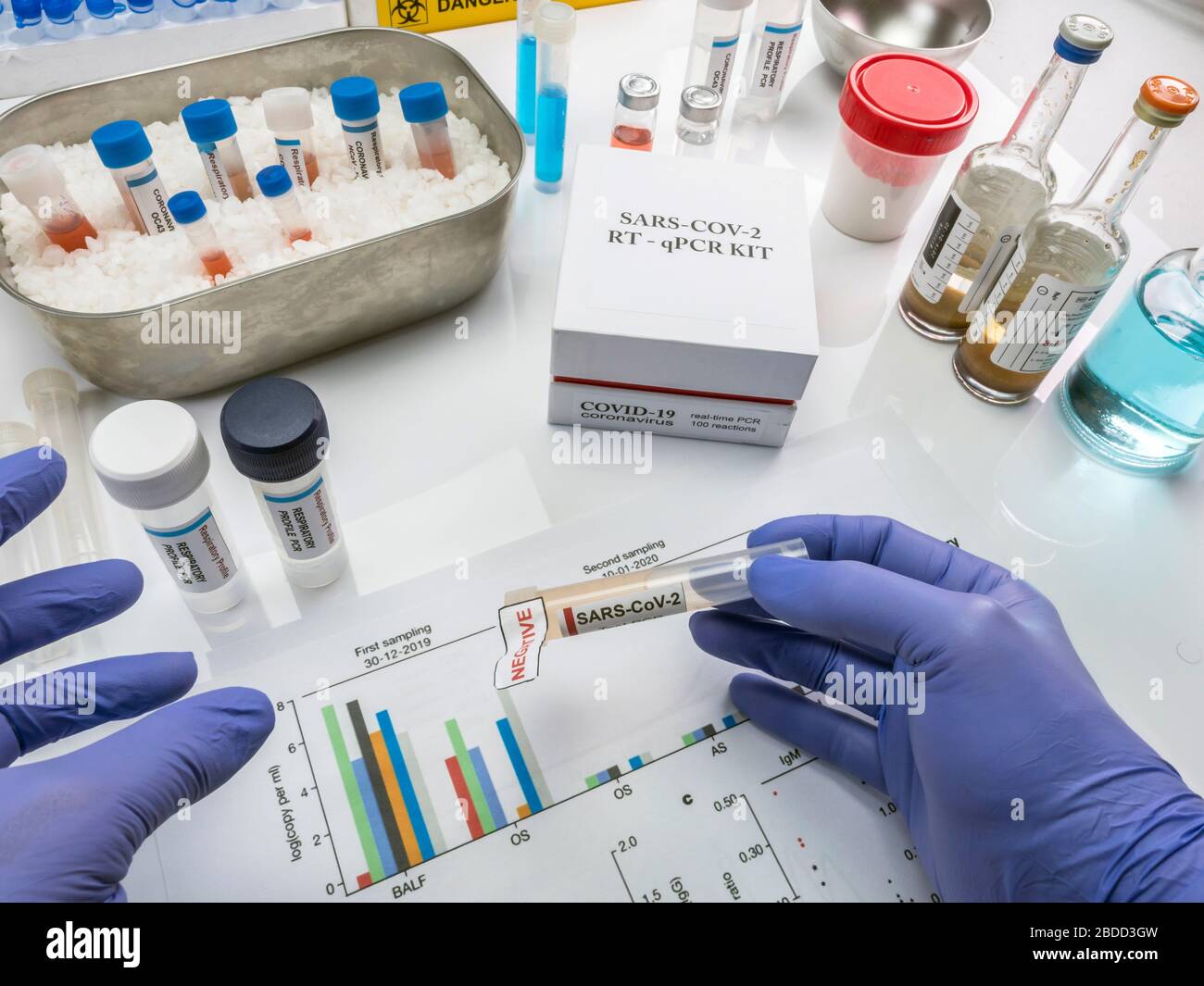 Novel coronavirus 2019 nCoV pcr diagnostics kit. This is RT-PCR kit to ...