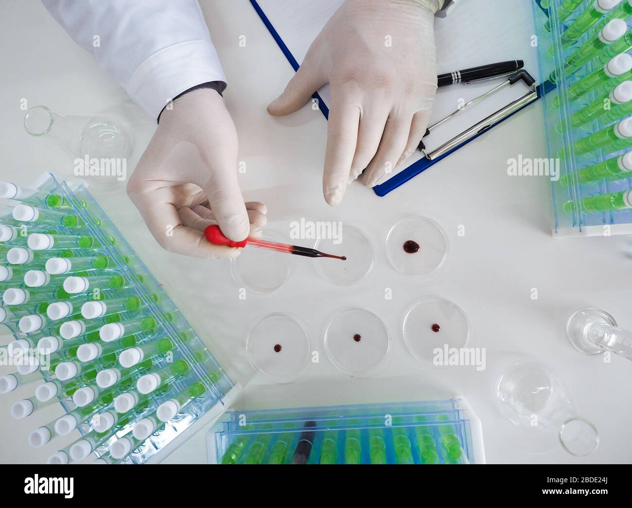 Analysing of blood sample hi-res stock photography and images - Alamy