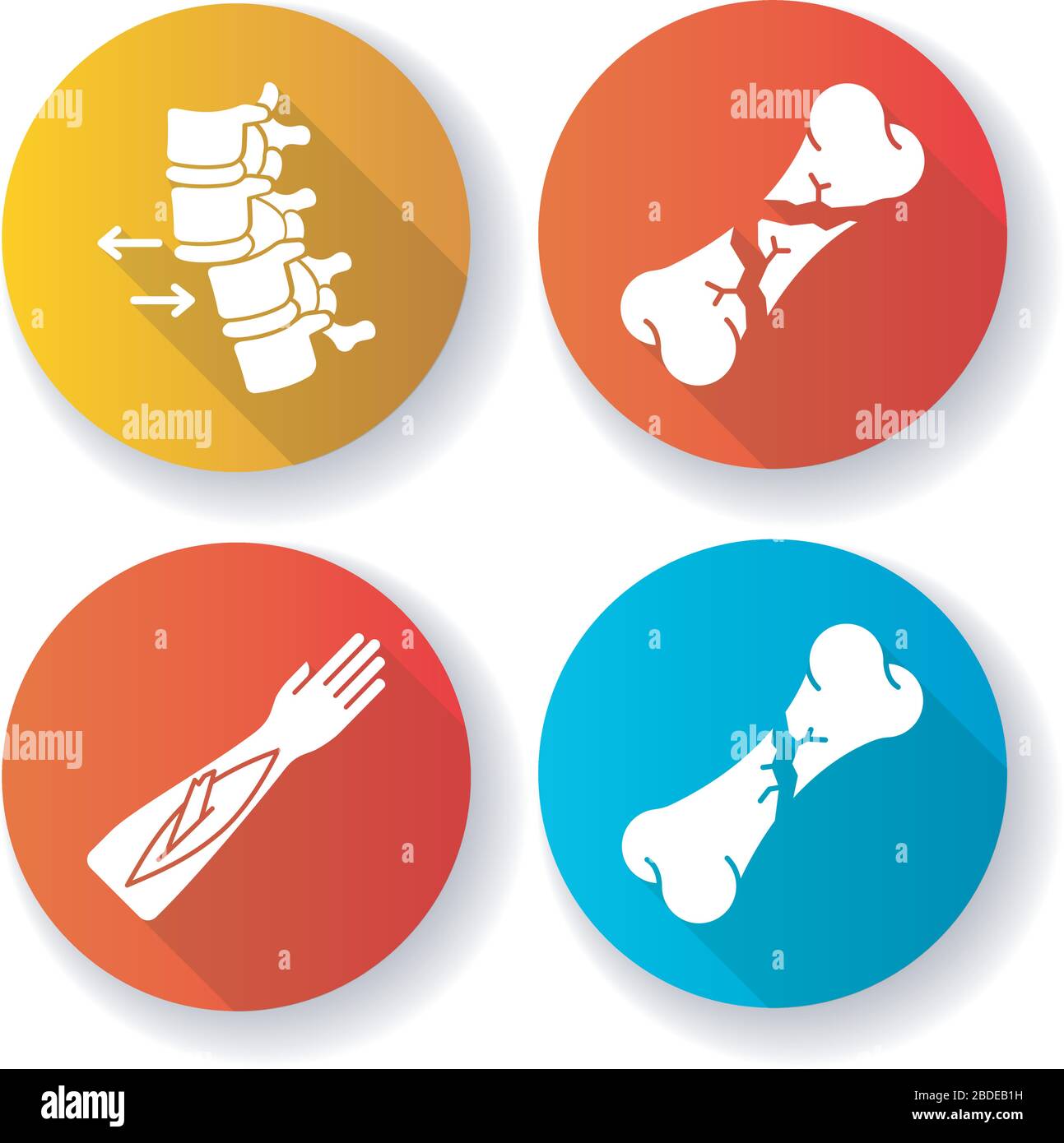 Vertebra fracture spine dislocation hi-res stock photography and images ...