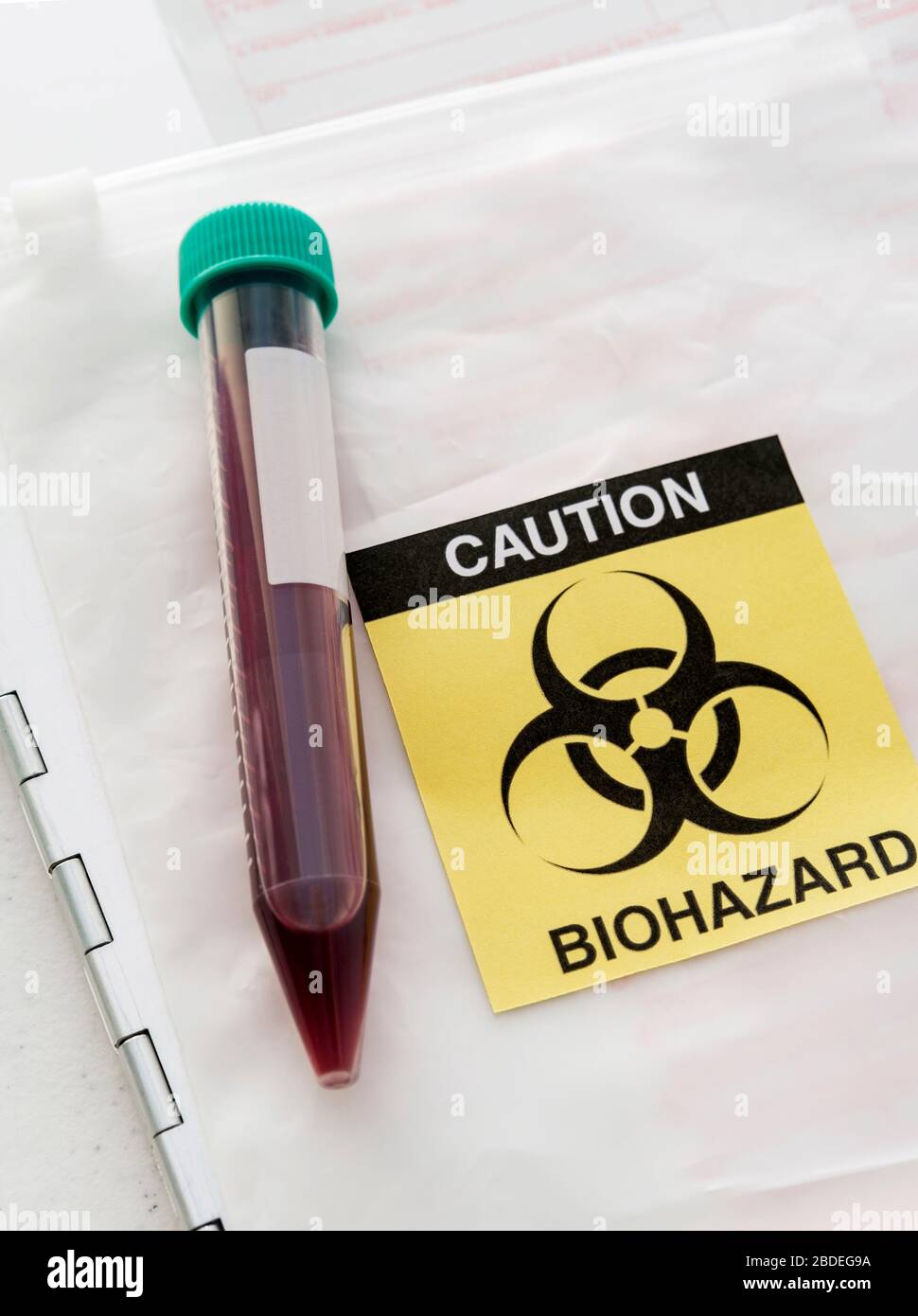 Blood sample with biohazard sign Stock Photo - Alamy