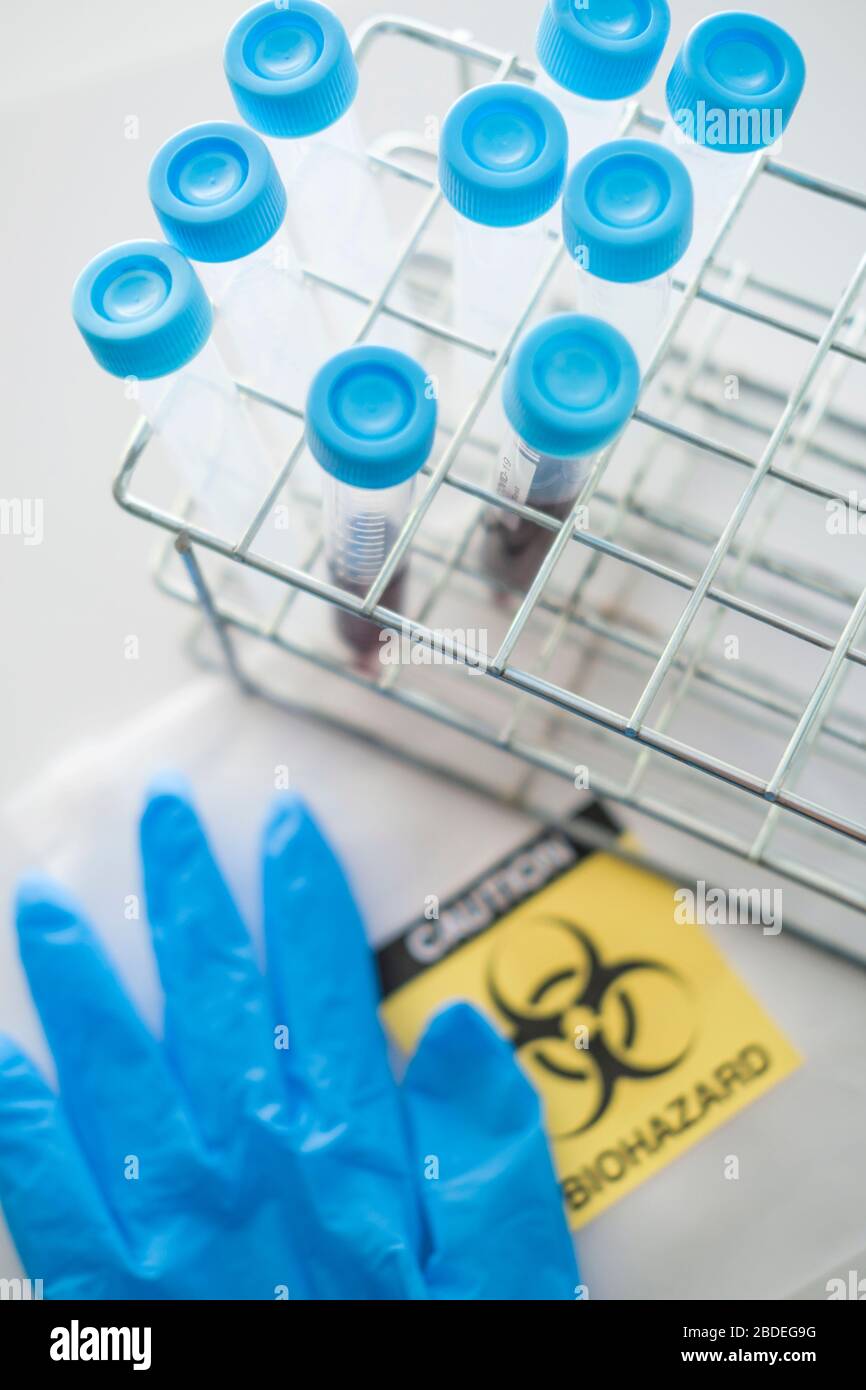 Blood samples withÂ biohazardÂ sign and surgical glove Stock Photo - Alamy