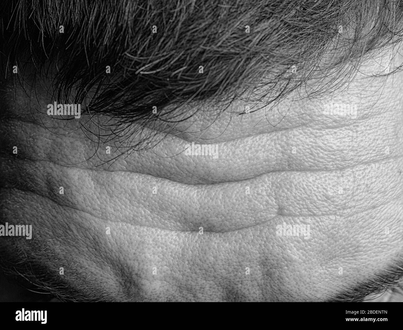Black and white photo of a male forehead with wrinkles and porous skin ...