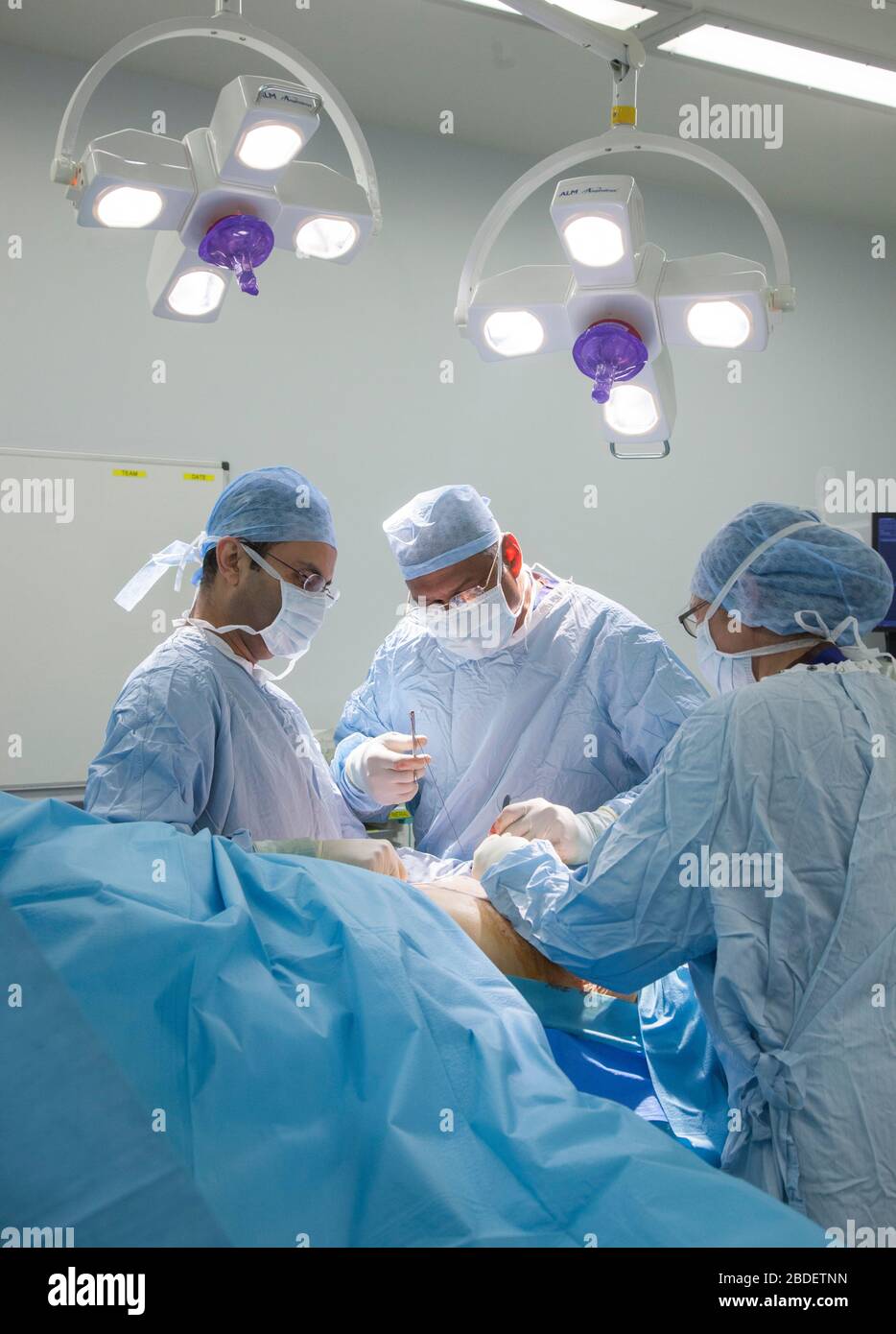 Surgeons and nurses perform stomach surgery in an NHS hospital. The NHS ...