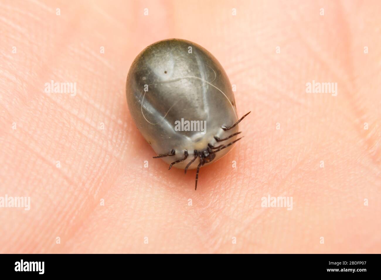 close-up photo of a tick on human skin Stock Photo - Alamy