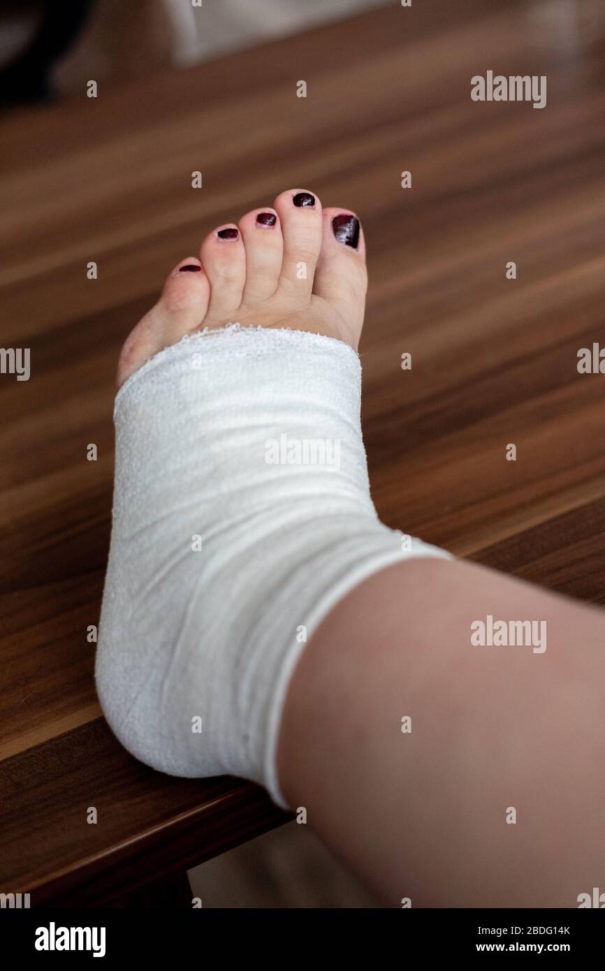 Bandaged ankle hi-res stock photography and images - Alamy