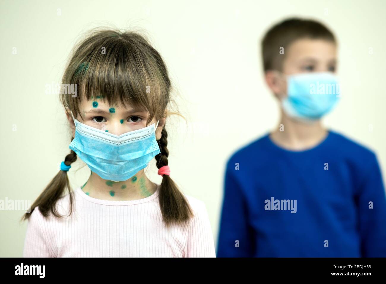 Boy and girl wearing blue protective medical mask ill with chickenpox ...