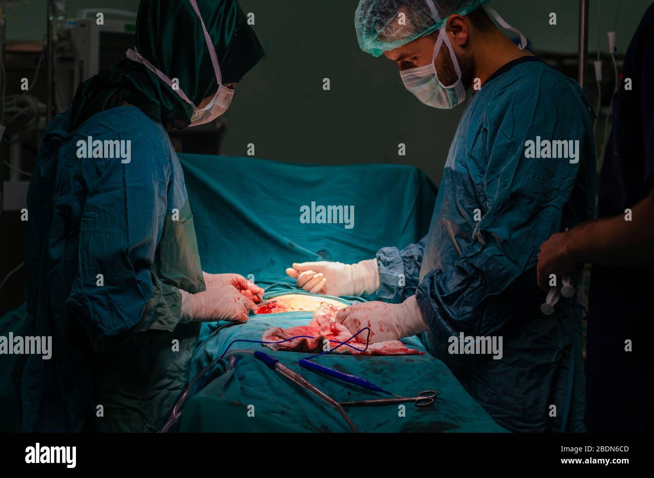 Female gynecologist doctor is sewing the skin after surgery Stock Photo ...