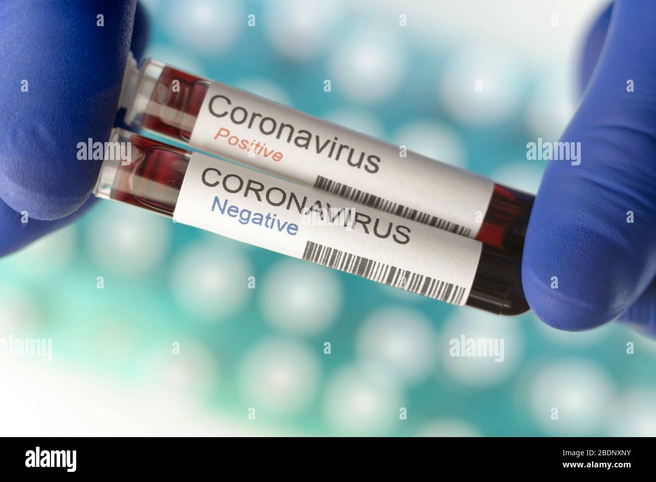 One negative and one positive result of coronavirus tests hi-res stock ...