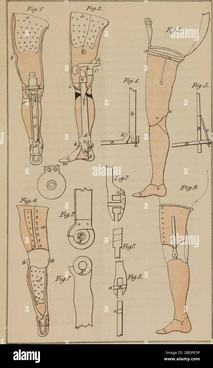 "Vulcanite rubber artificial limbs, arms and legs, moulded from life in ...