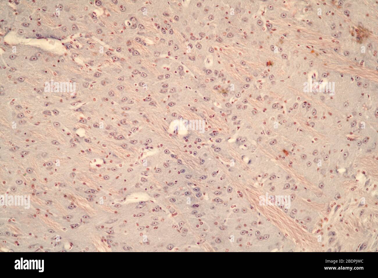 Brain cells tissue under the microscope 100x Stock Photo - Alamy