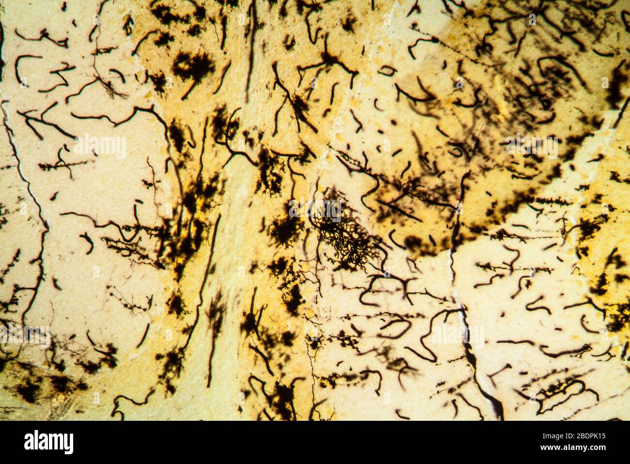 Brain cells tissue under the microscope 100x Stock Photo - Alamy