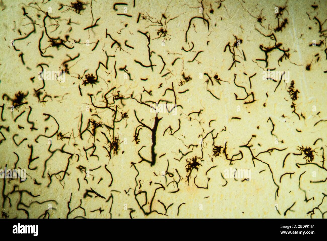 Brain cells tissue under the microscope 100x Stock Photo - Alamy