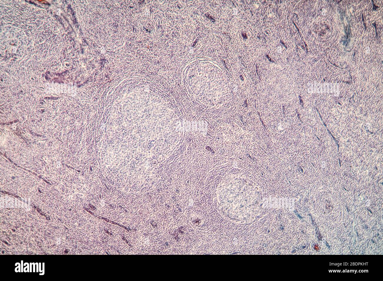Palatal tonsils transverse 100x under a microscope Stock Photo - Alamy