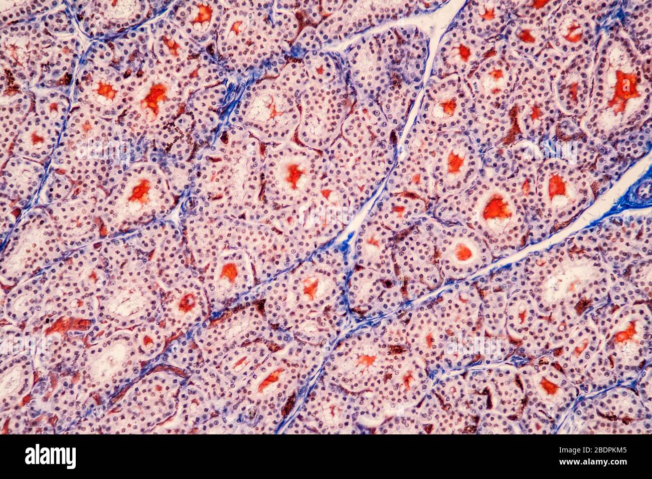 Thyroid gland capsule hi-res stock photography and images - Alamy