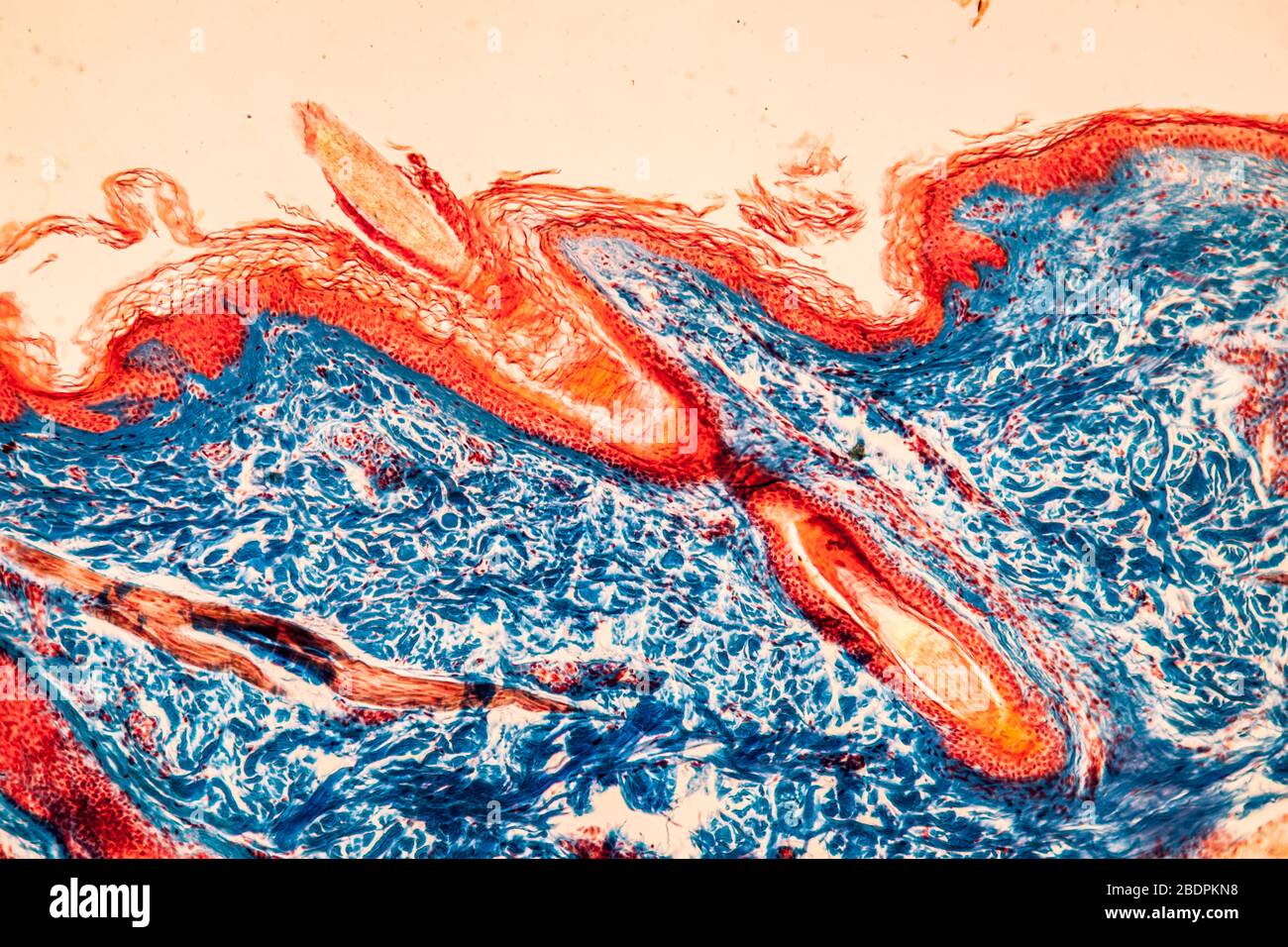 Scalp with hair roots tissue under the microscope 100x Stock Photo - Alamy