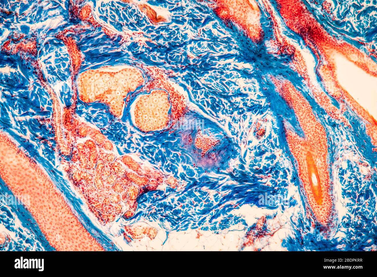 Scalp with hair roots tissue under the microscope 100x Stock Photo - Alamy