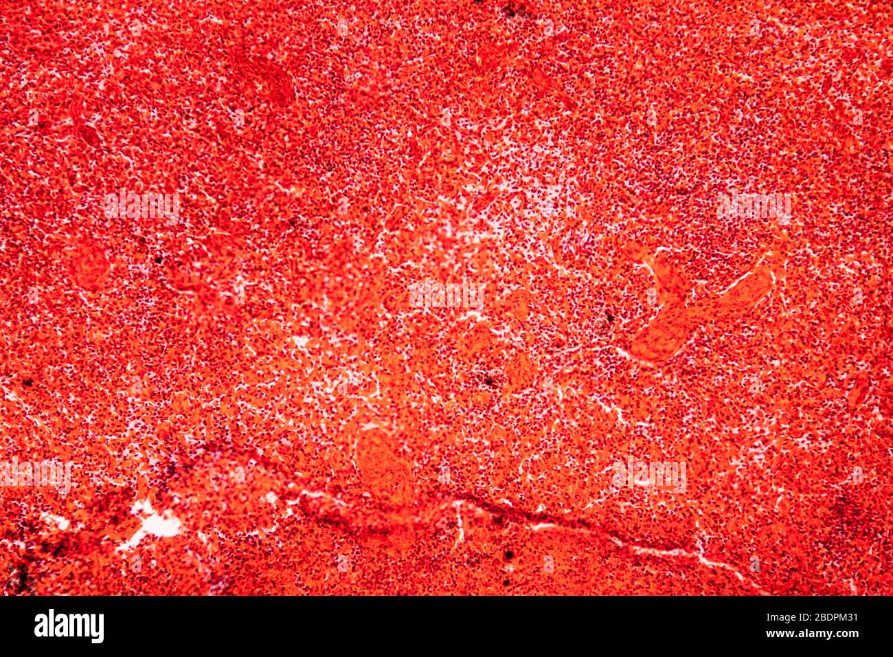 Spleen tissue under the microscope 100x Stock Photo - Alamy