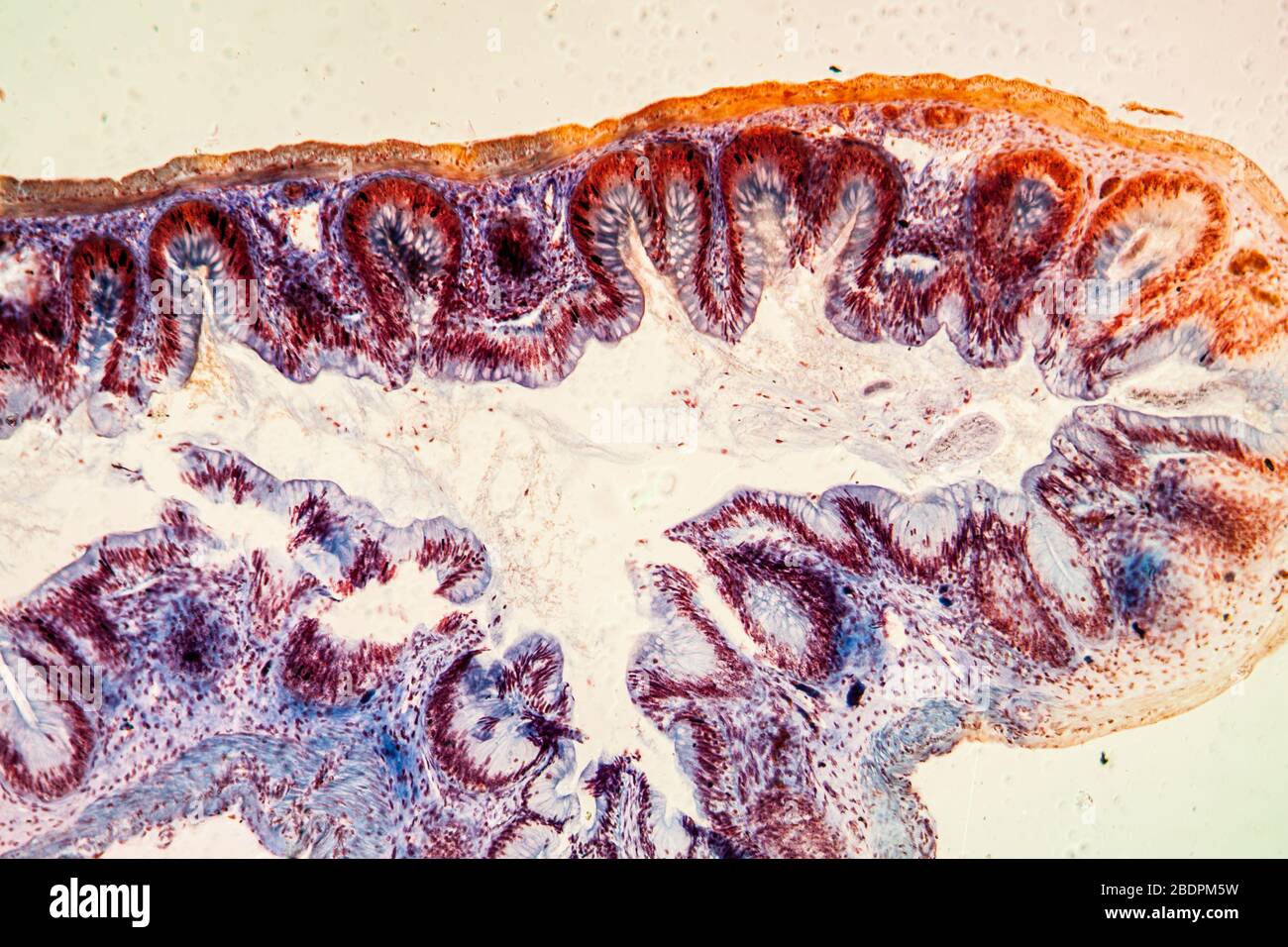 Colon with villi tissue under the microscope 100x Stock Photo - Alamy