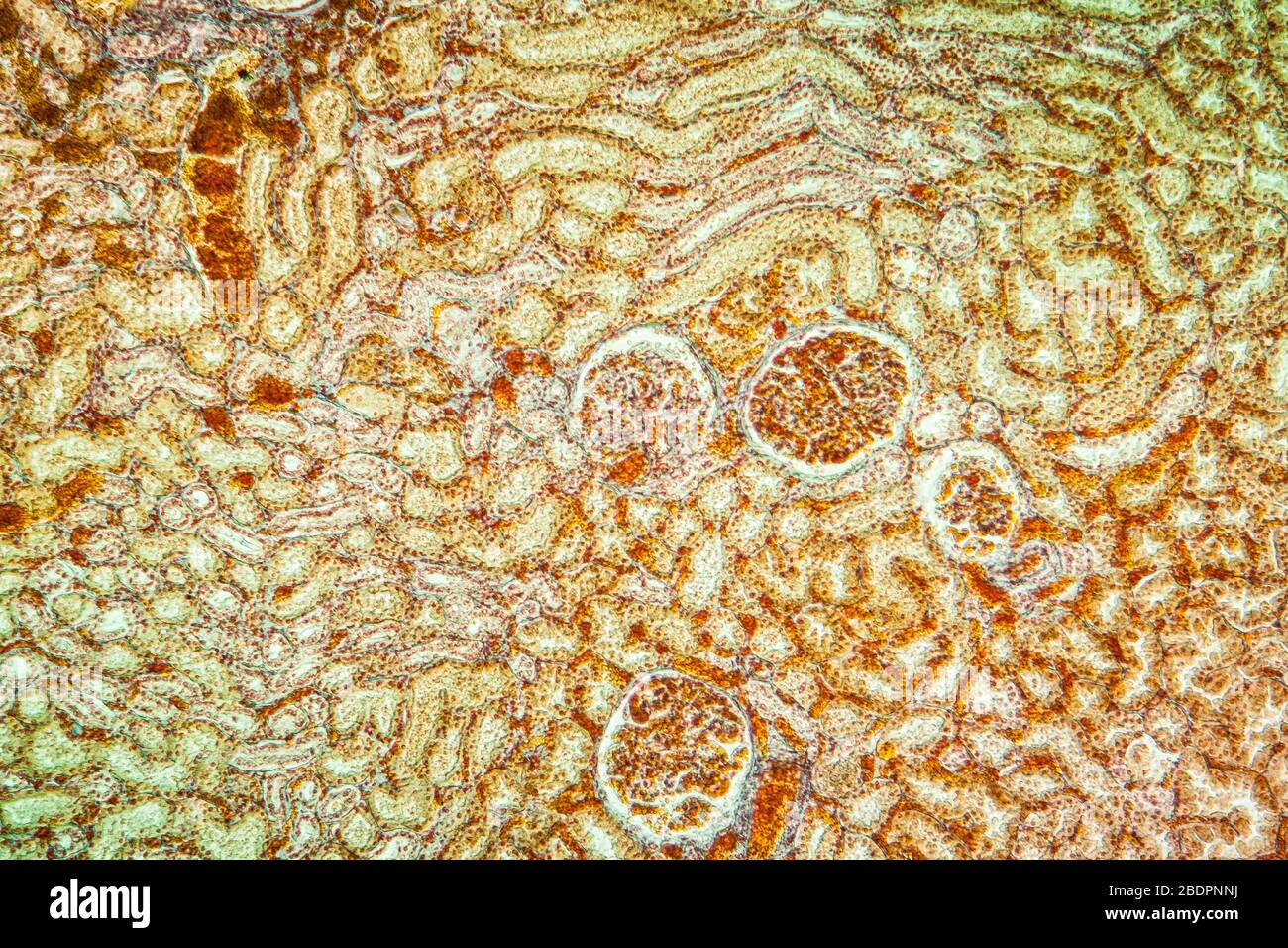 Billirubin kidney Diseased tissue 100x Stock Photo - Alamy