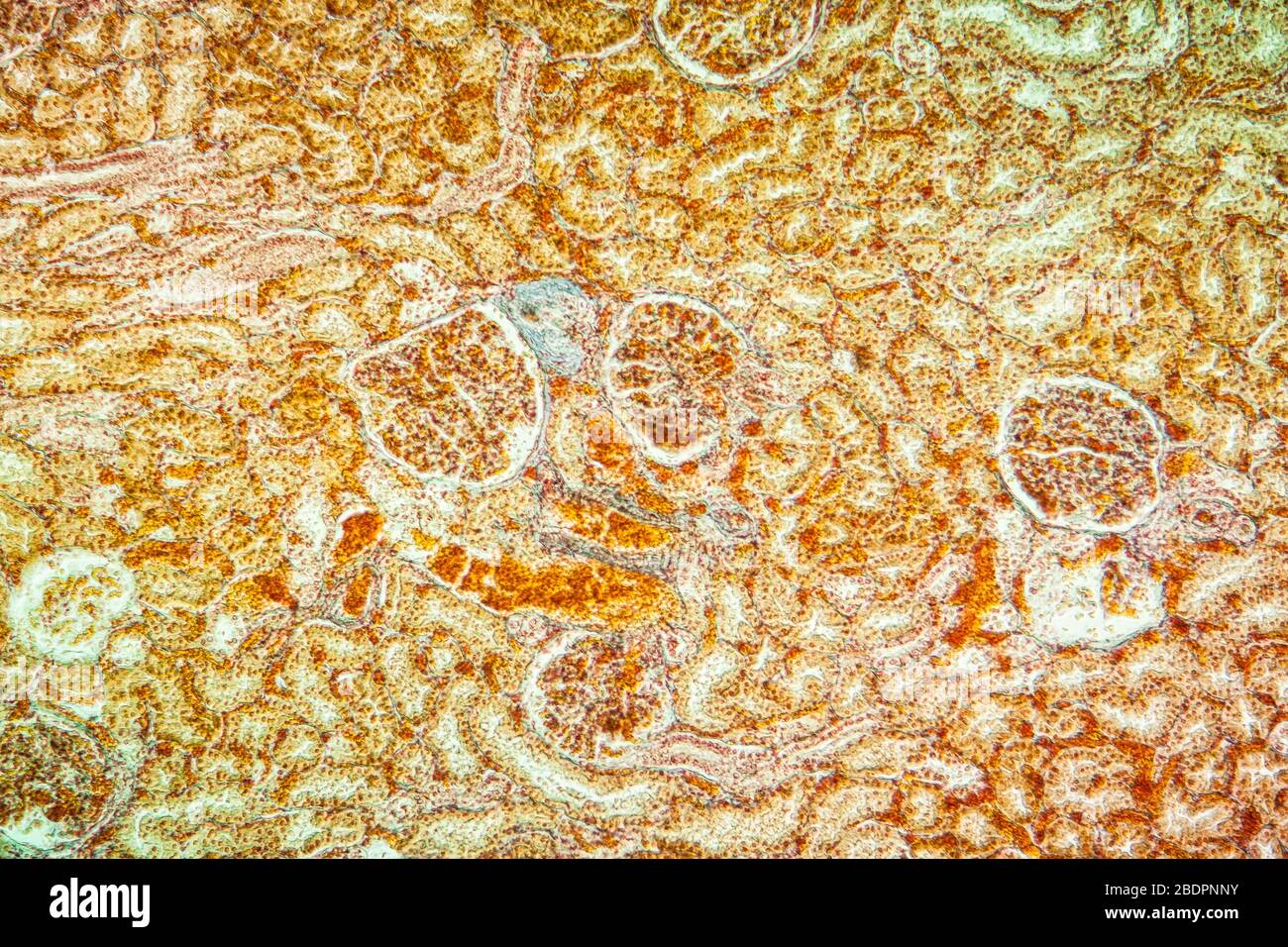 Billirubin kidney Diseased tissue 100x Stock Photo - Alamy
