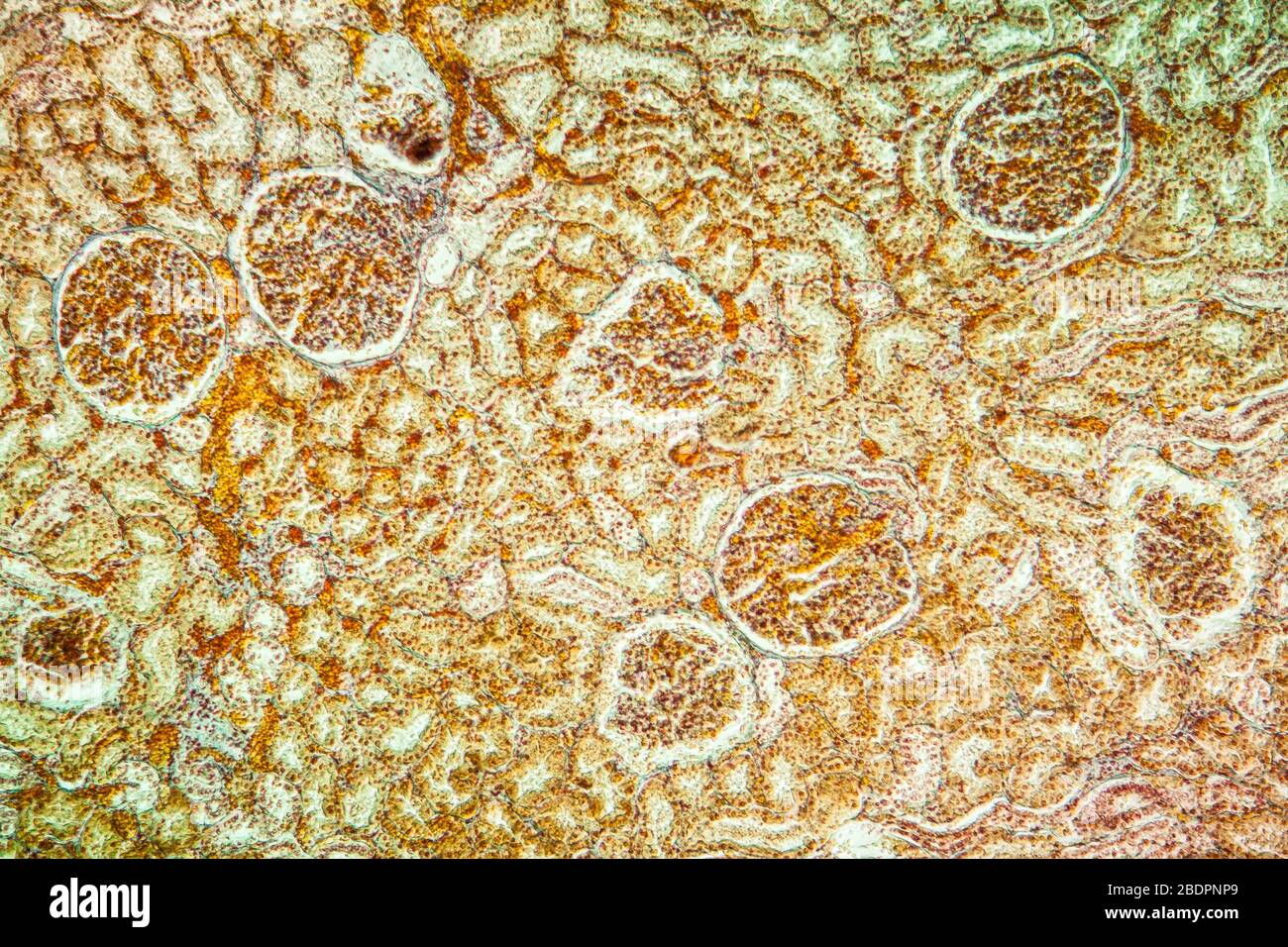 Billirubin kidney Diseased tissue 100x Stock Photo - Alamy