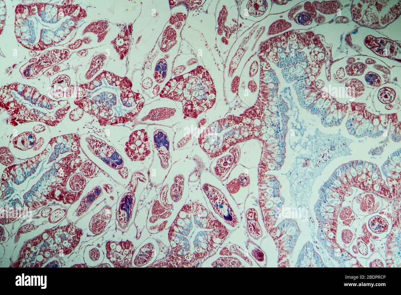 Fluke worms hi-res stock photography and images - Alamy